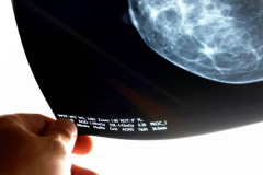 Courses - RadComm Education - Initial Mammography Training