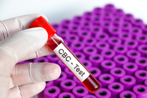 The Holistic Guide to CBC; Numbers, Plots and Morphology. Making Sense ...